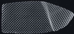 Hernia Mesh Lawsuit General Information & Updates: July 2023 - Recalls ...