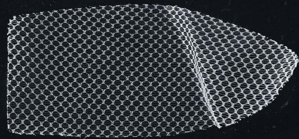 Hernia Mesh Lawsuit General Information & Updates: July 2023 - Recalls ...