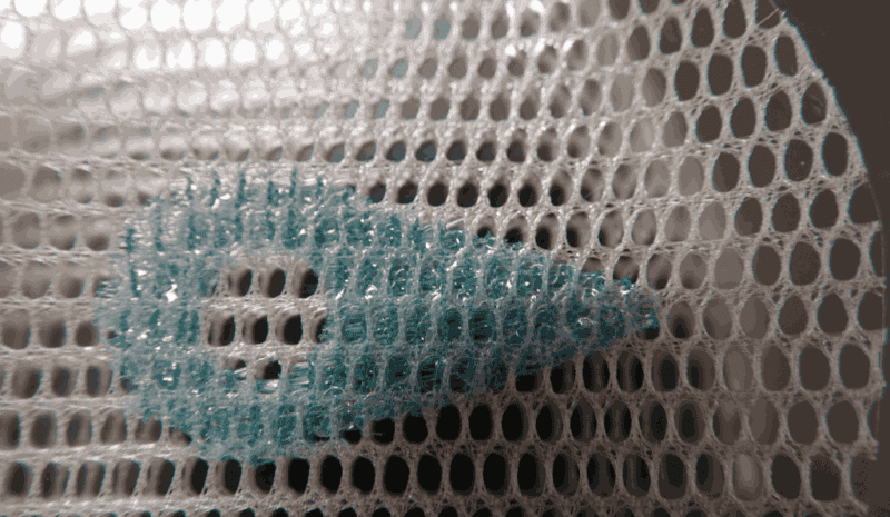 Covidien Hernia Mesh Lawsuit: Side Effects, Recalls, and Litigation Updates