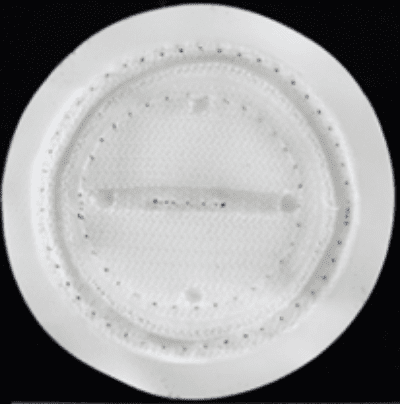 Ventralex Hernia Mesh Lawsuit | Nigh Goldenberg Raso & Vaughn