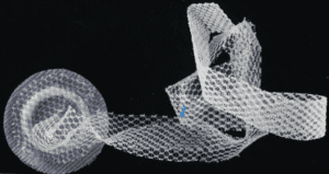 Hernia Mesh Lawsuit General Information & Updates: July 2023 - Recalls ...